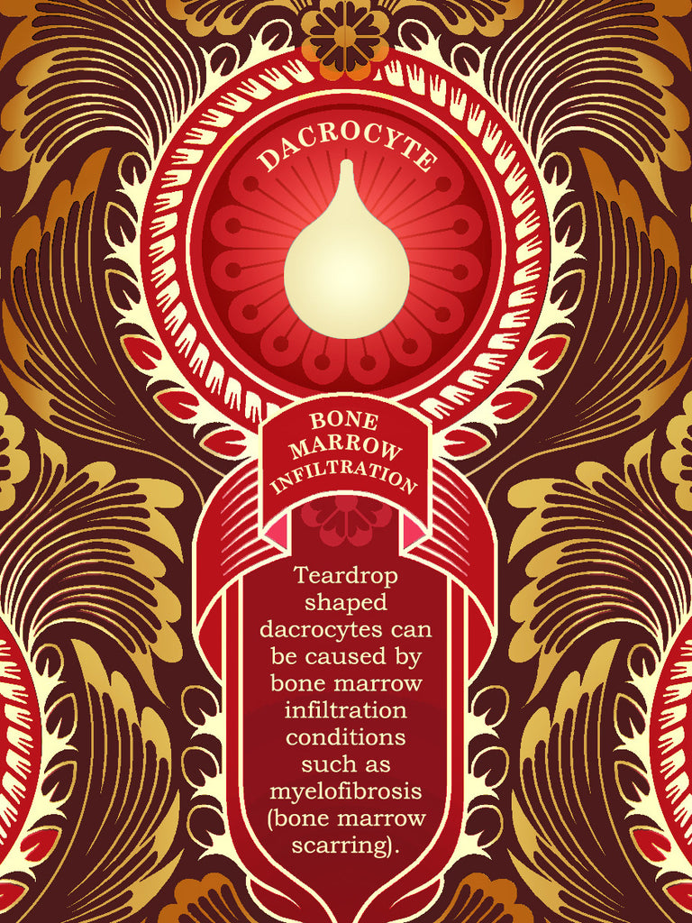 Abnormal Erythrocytes Poster – NerdcoreMedical